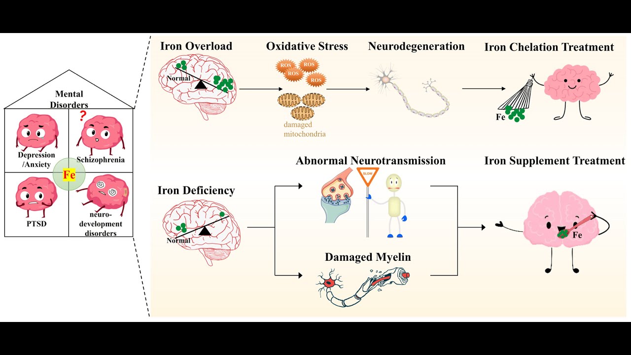 Iron Overload Treatment