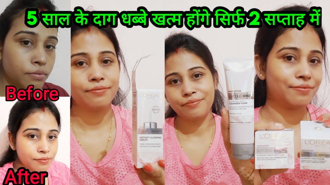 L'Oréal Paris Glycolic Bright Range 2 Weeks Review with Before & After ...