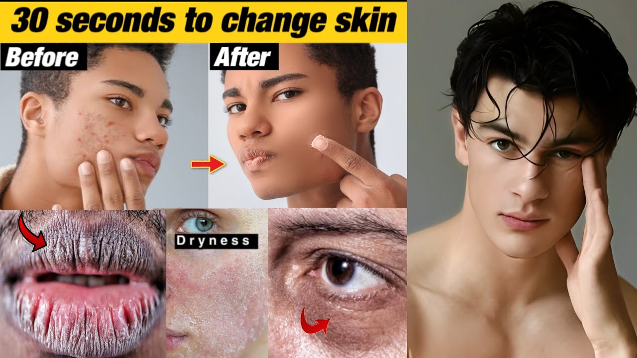 30 seconds to change your skin - YouTube