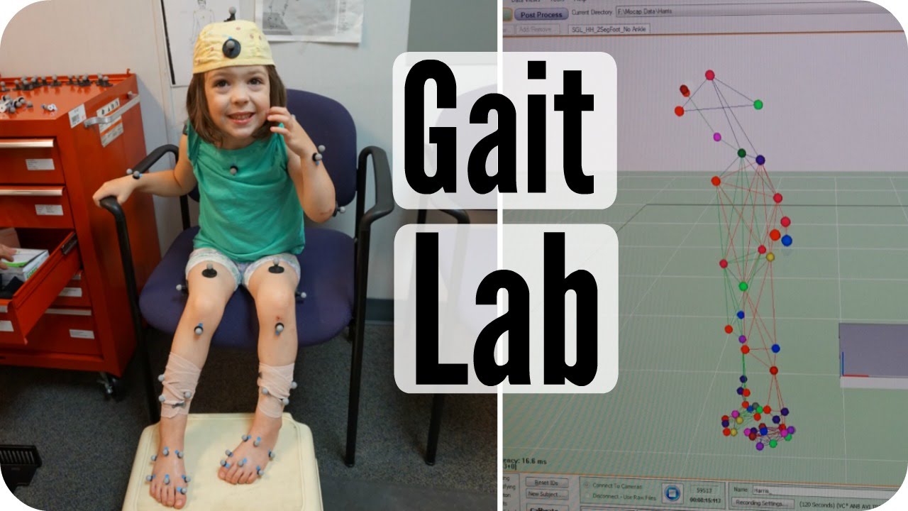Gait Lab & FT | Week 50-B - YouTube