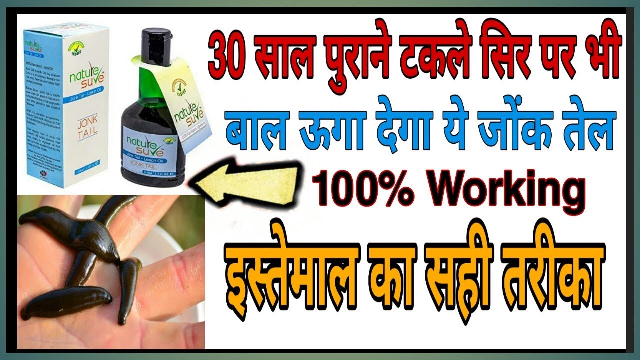 Jonk oil benefits in hindi / गंजेपन से मुक्ति / jonk oil for hair loss ...