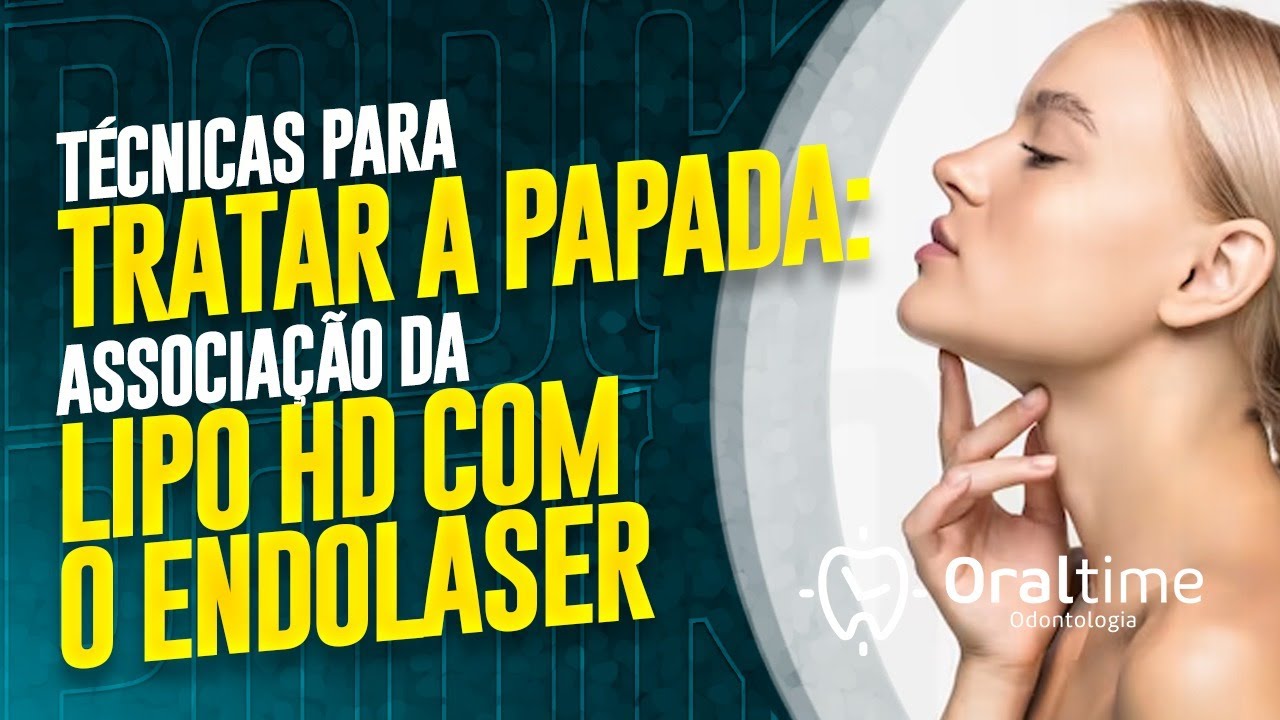 Técnicas para tratar papada: associação da Lipo HD com o Endolaser ...