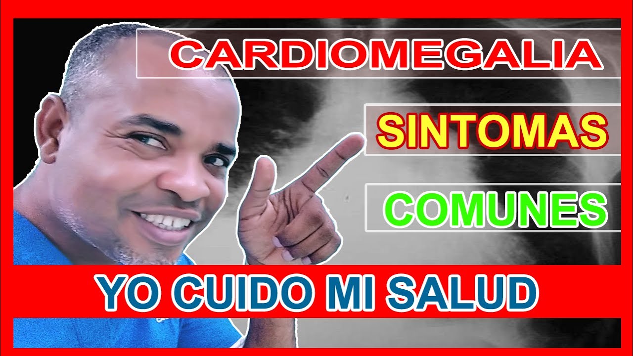 𝐄𝐬𝐭𝐨𝐬 𝐬𝐨𝐧 𝐥𝐨𝐬 𝐏𝐑𝐈𝐌𝐄𝐑𝐎𝐒 𝐒Í𝐍𝐓𝐎𝐌𝐀𝐒 𝐝𝐞 𝐋𝐚 𝐂𝐚𝐫𝐝𝐢𝐨𝐦𝐞𝐠𝐚𝐥𝐢𝐚 | 𝐐𝐮𝐞 𝐍𝐨 𝐃𝐄𝐁𝐄 ...