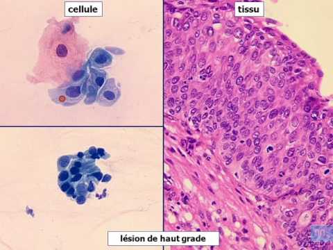 introduction a l'anatomie pathologique lésions élémentaires acteurs de ...