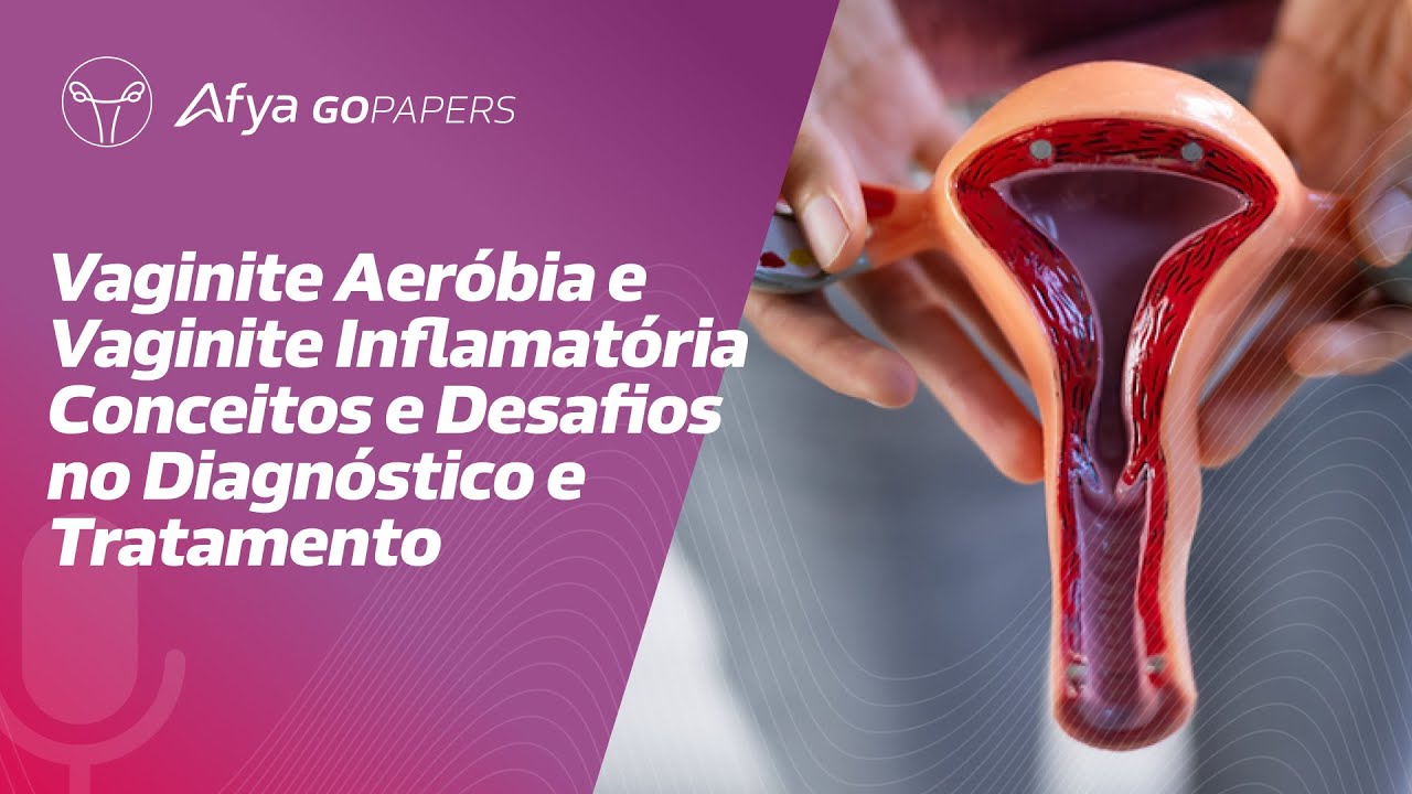 Vaginite aeróbia e vaginite inflamatória conceitos e desafios no ...