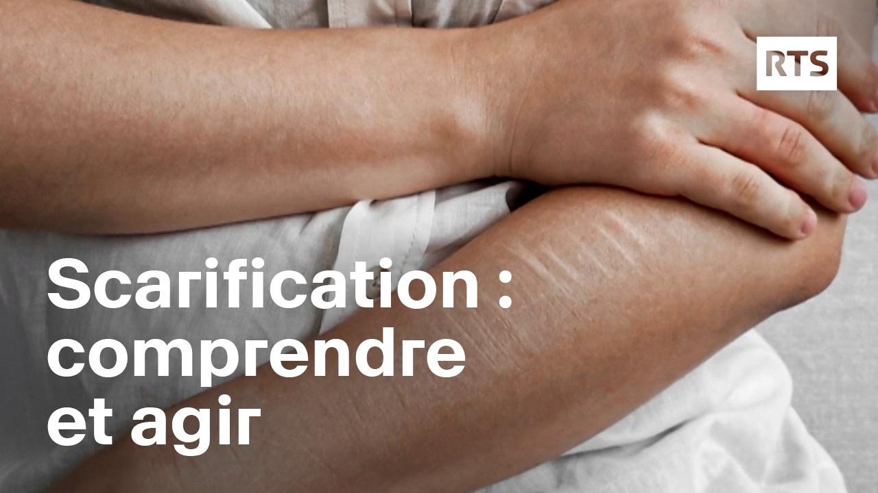 Scarification chez les adolescents : comprendre et prendre en charge ...