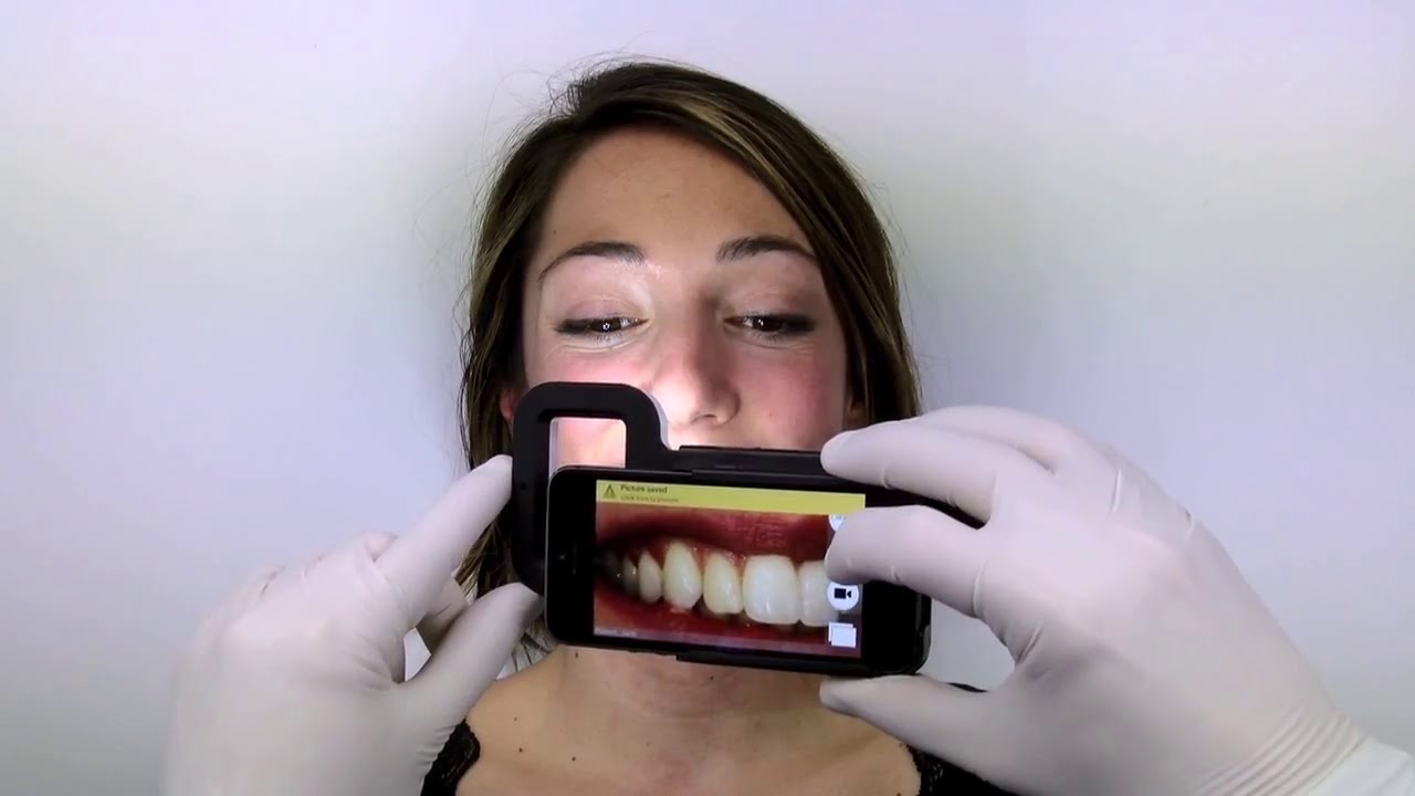 Smile Capture 210314 720p - YouTube