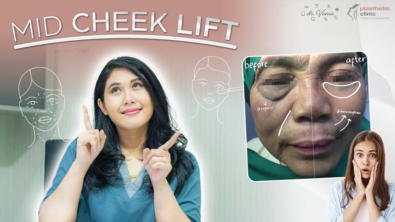 LEBIH MUDA 10 TAHUN SETELAH OPERASI PLASTIK INI! | PLASTIC SURGEON ...