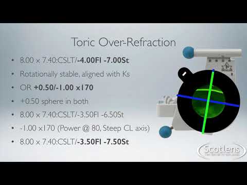 Toric GP Over Refraction | Scotlens Custom Fit Contact Lenses - YouTube