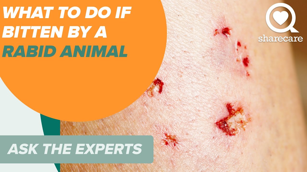 What to Do if Bitten by a Rabid Animal | Ask the Experts | Sharecare ...