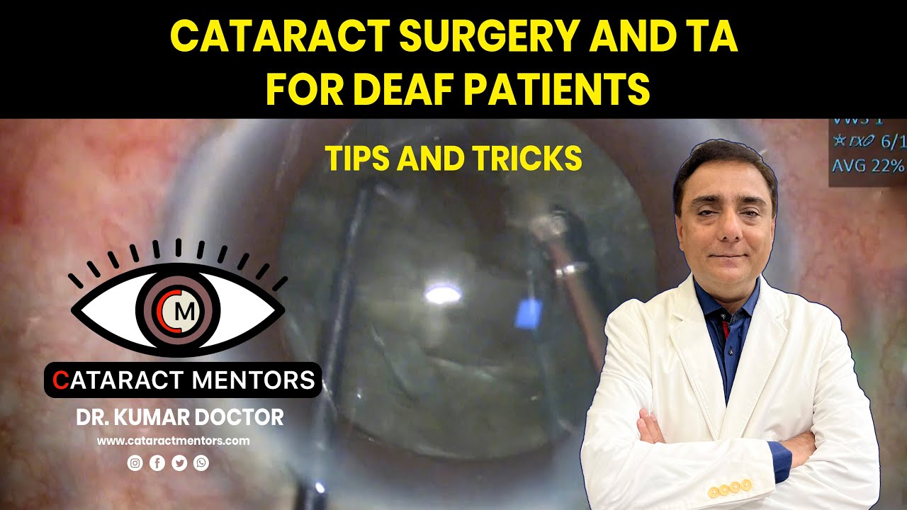 Cataract Surgery made Simple for Deaf Patients - YouTube