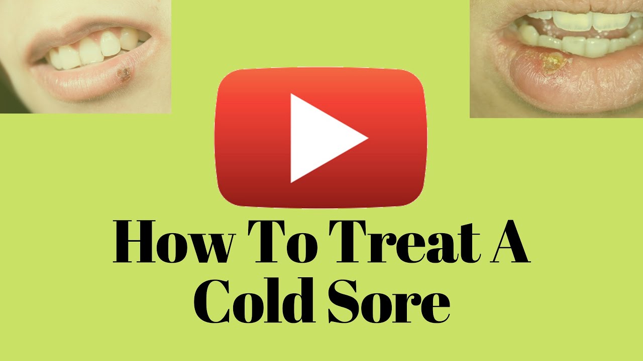How To Treat A Cold Sore - YouTube