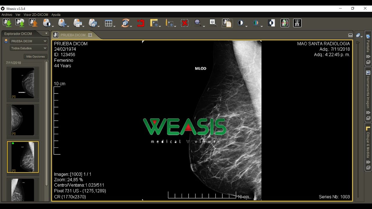 Weasis for Dcm4chee Mac OS - YouTube