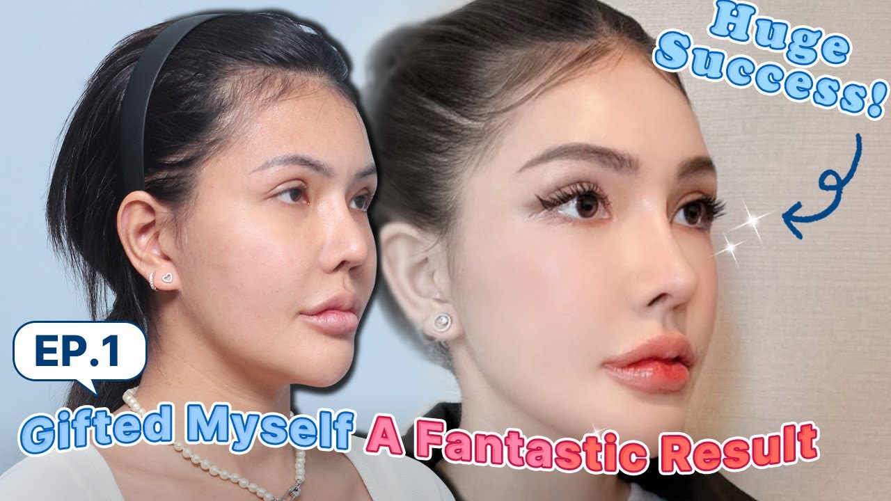 [SUB] Our dear patient coming back to NANA for another surgery! Join ...