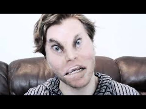 Onision but every time he is Onision the video gets more distorted