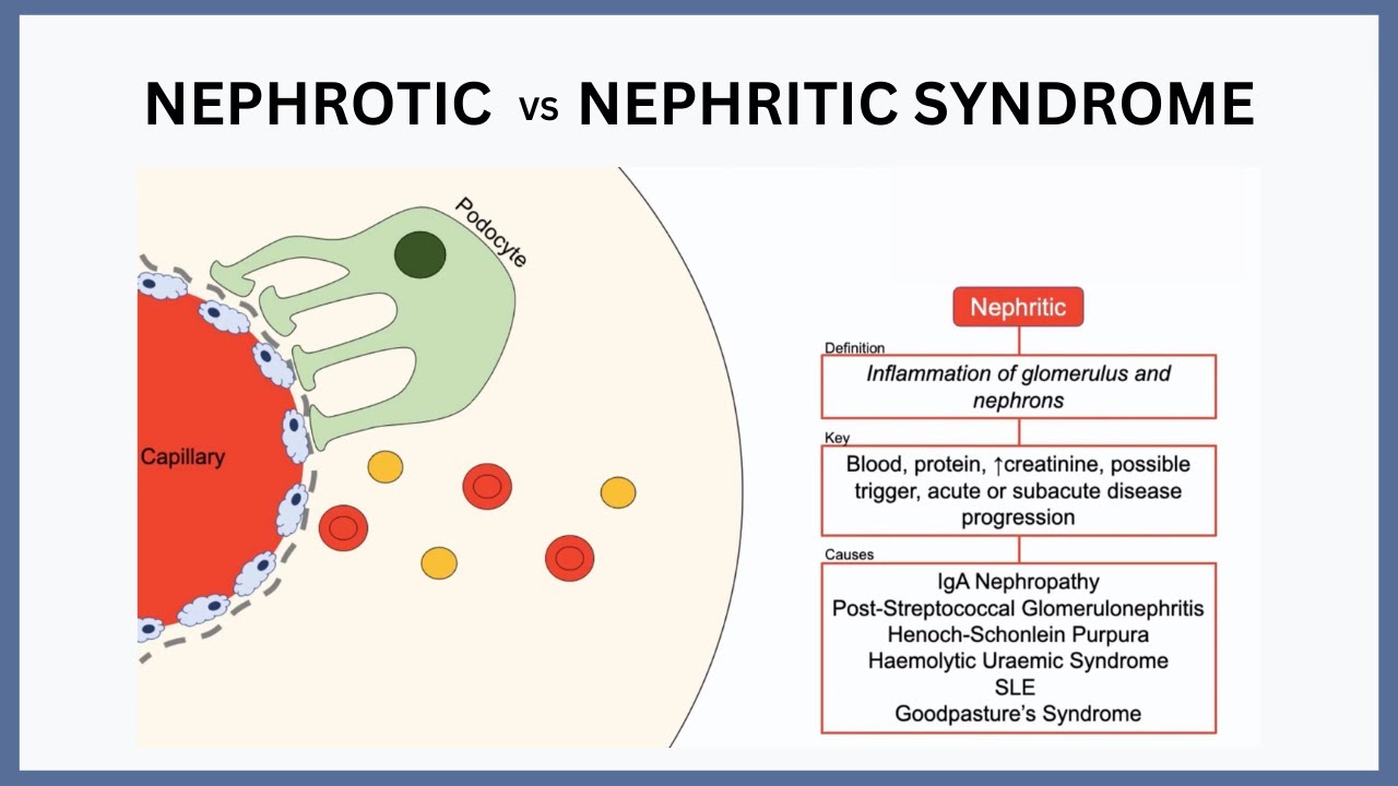 Nephritic vs Nephrotic Syndrome Explained - YouTube