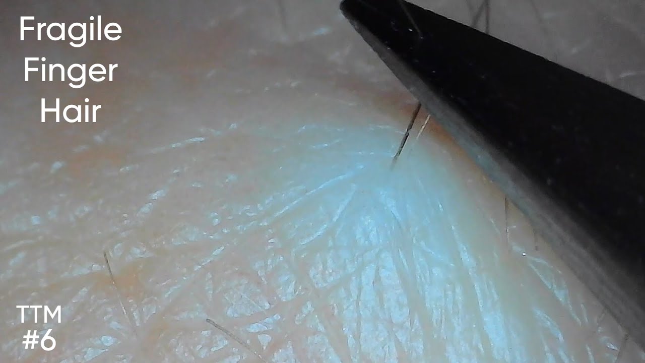 Hairs on the Finger Can Be Fragile and Frustrating | Tweeze & Pluck ...