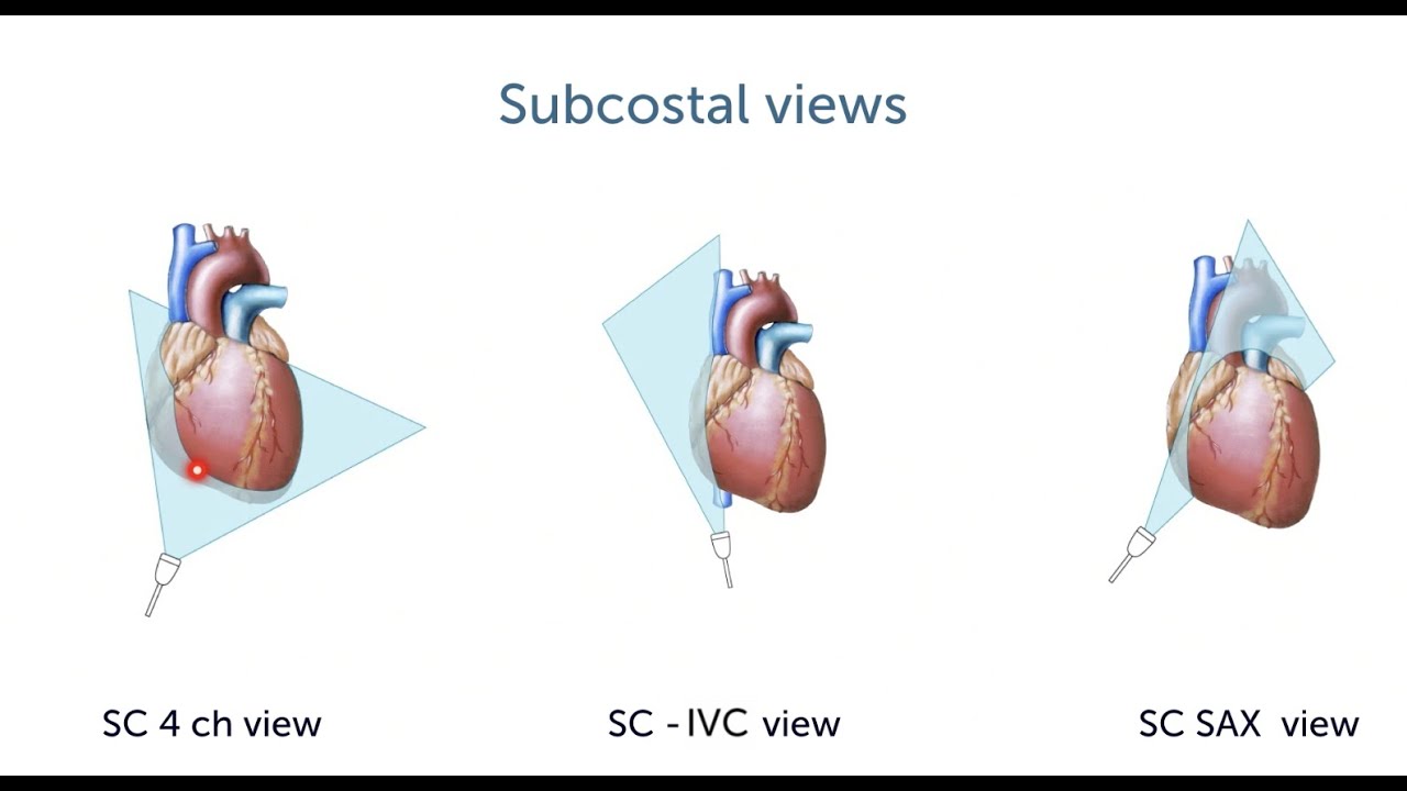 How can I find the heart in a subcostal view? - YouTube