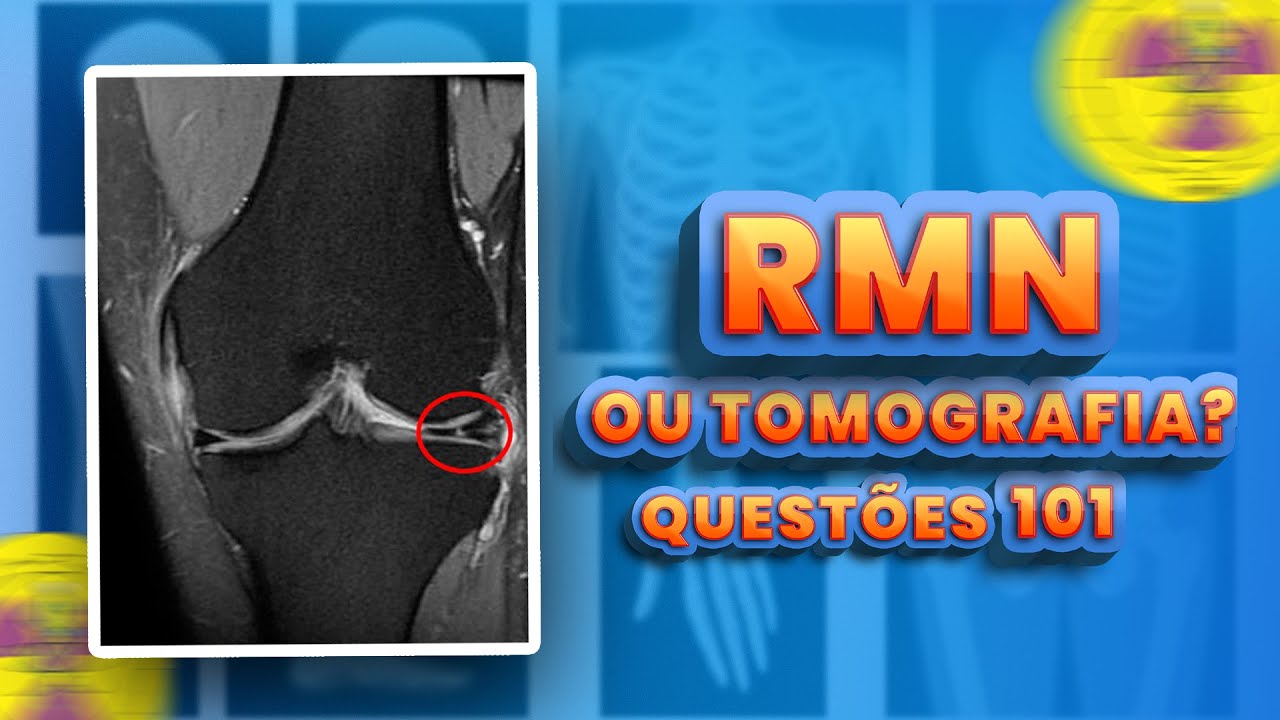 QUESTÕES COMENTADAS DE RADIOLOGIA 101 - YouTube