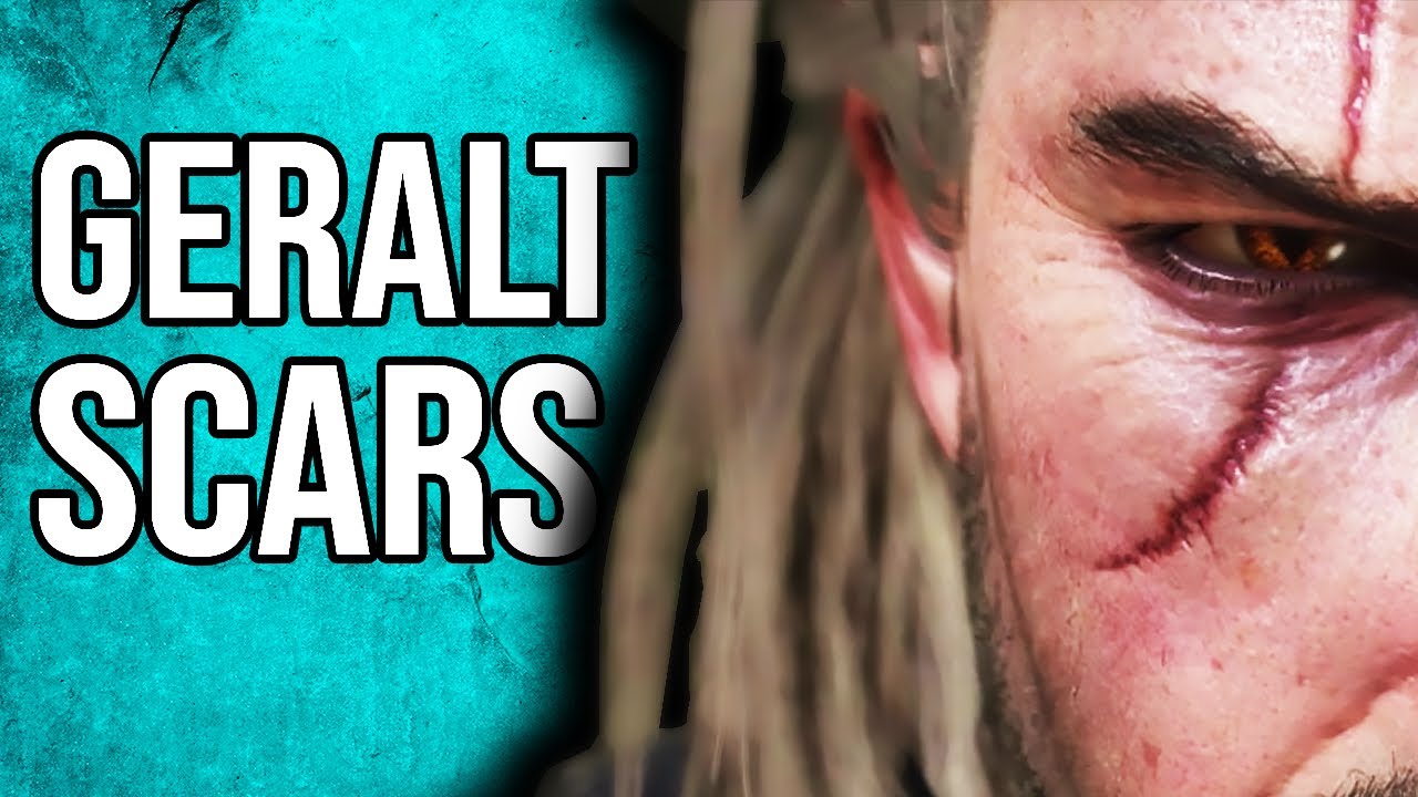 Witcher 3 Geralt's Scars - YouTube