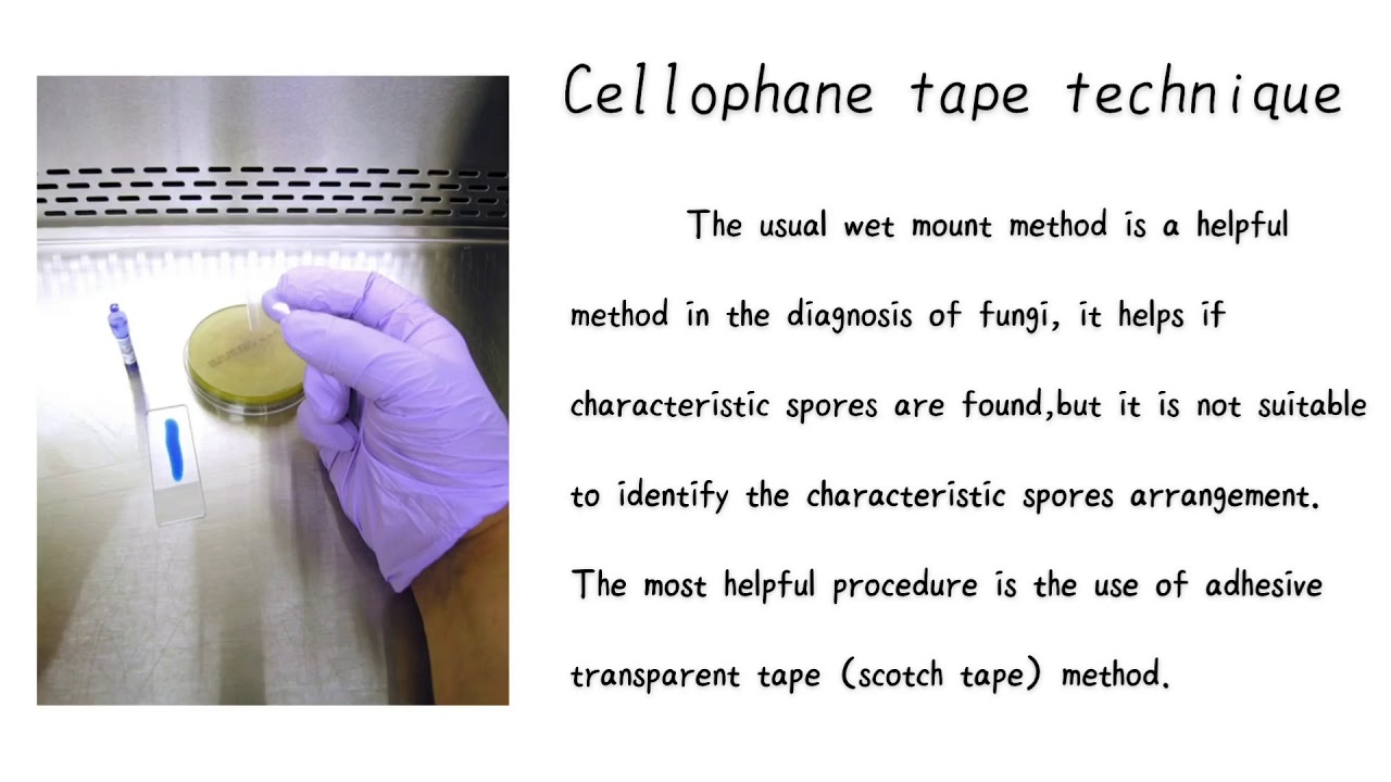 Cellophane tape technique - YouTube