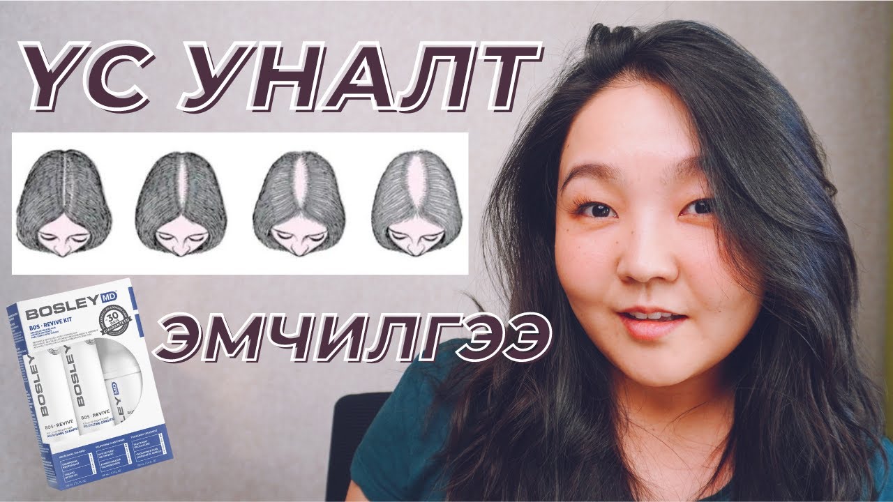 Үс уналтын тухай Шинж тэмдэг нөлөөлөгч хүчин зүйлс болон эмчилгээ