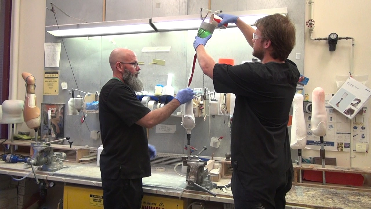 Shriners Prosthetics BK socket lamination - YouTube