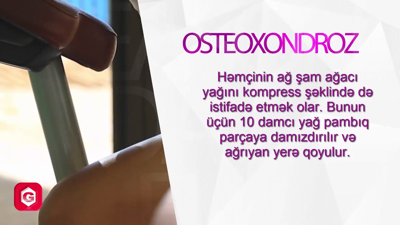 #Osteoxondroz nədir? Və təbii müalicə üsulları - YouTube