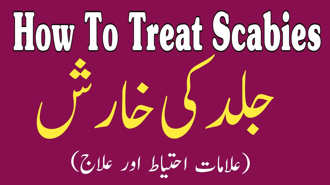 How To Treat Scabies at home Urdu & Hindi - YouTube