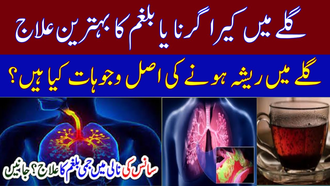 Galay me Balgham ka ilaj in Urdu | How to Treat Phlegm | Balgham Resha ...