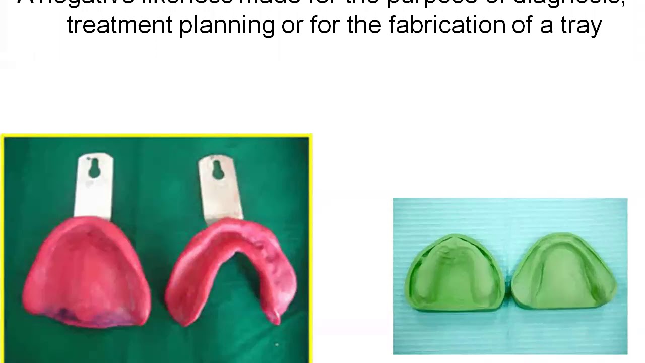 Steps in Denture Fabrication - YouTube