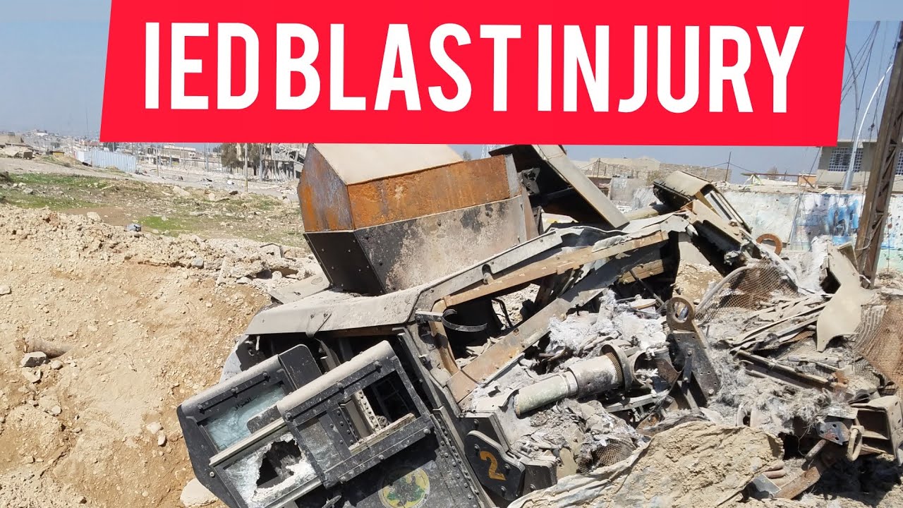 IED blast Injury - YouTube