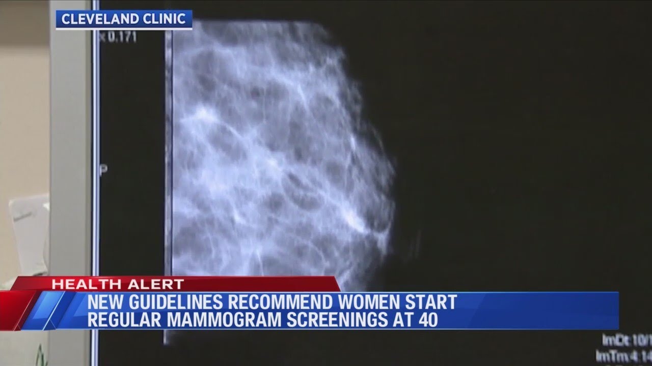 New mammogram guidelines recommend women start screenings at 40 - YouTube