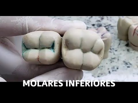 DESCRIPCIÓN BÁSICA DE LOS MOLARES INFERIORES PERMANENTES - YouTube