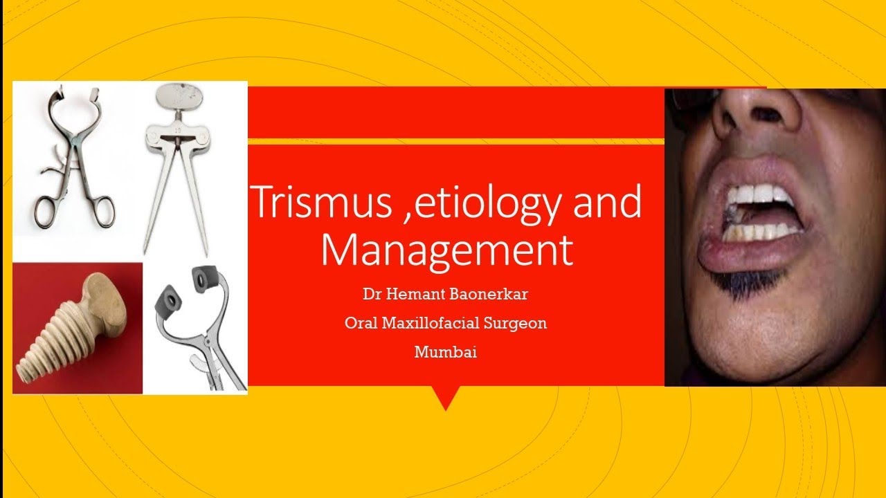 Trismus Management - YouTube