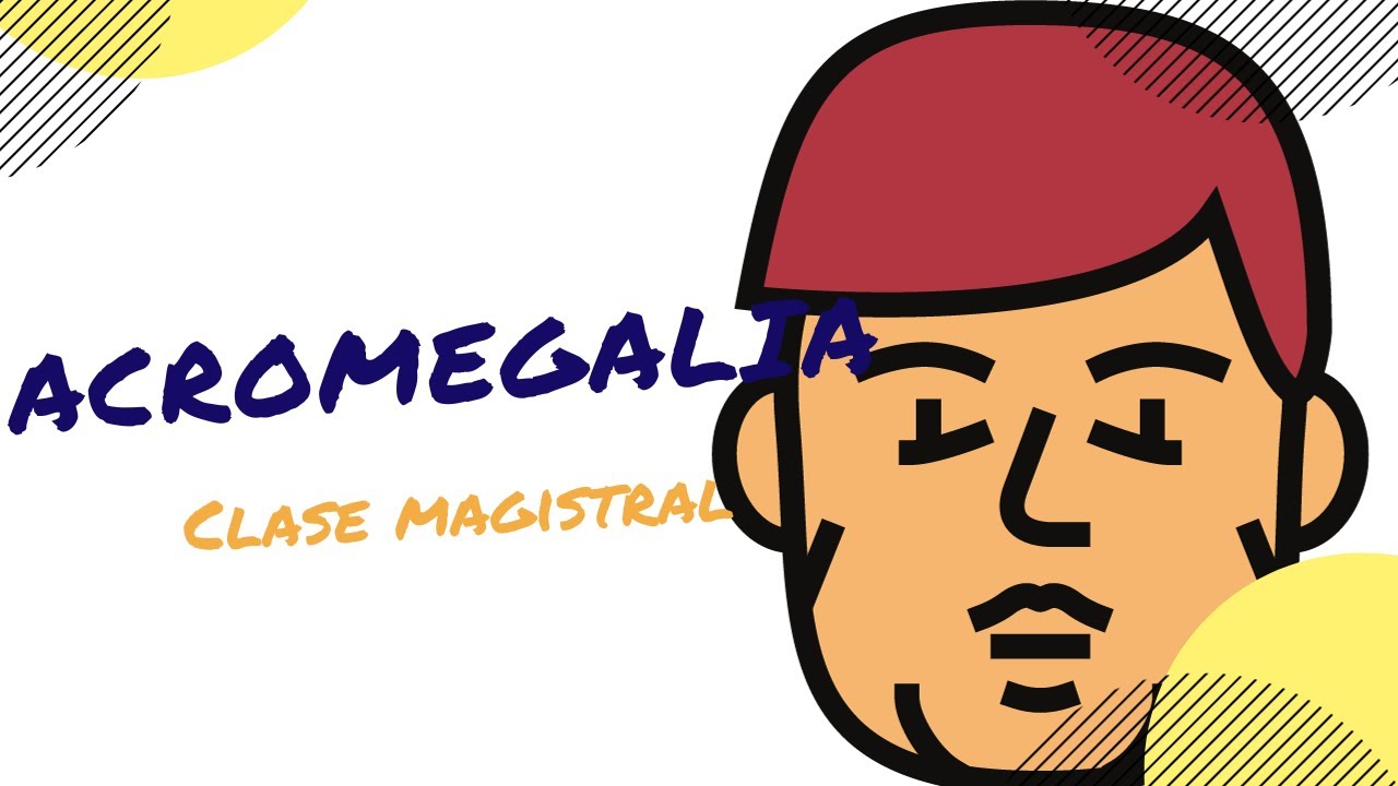 ACROMEGALIA - ¿qué es?, causas, síntomas, diagnóstico y tratamiento ...