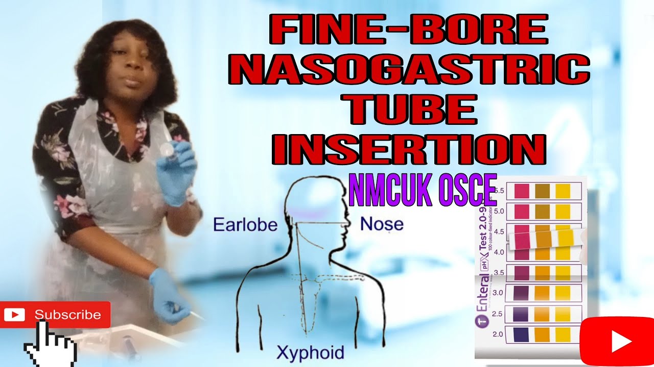 Fine Bore Nasogastric Tube Insertion New Nmcuk Osce Nursing Nasogastric Youtube