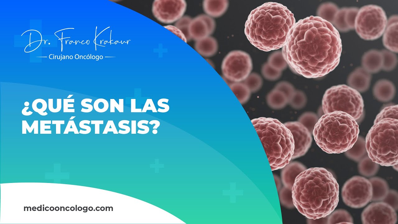 ¿Qué Son Las Metástasis? | Dr. Franco Krakaur | Médico Oncólogo - YouTube