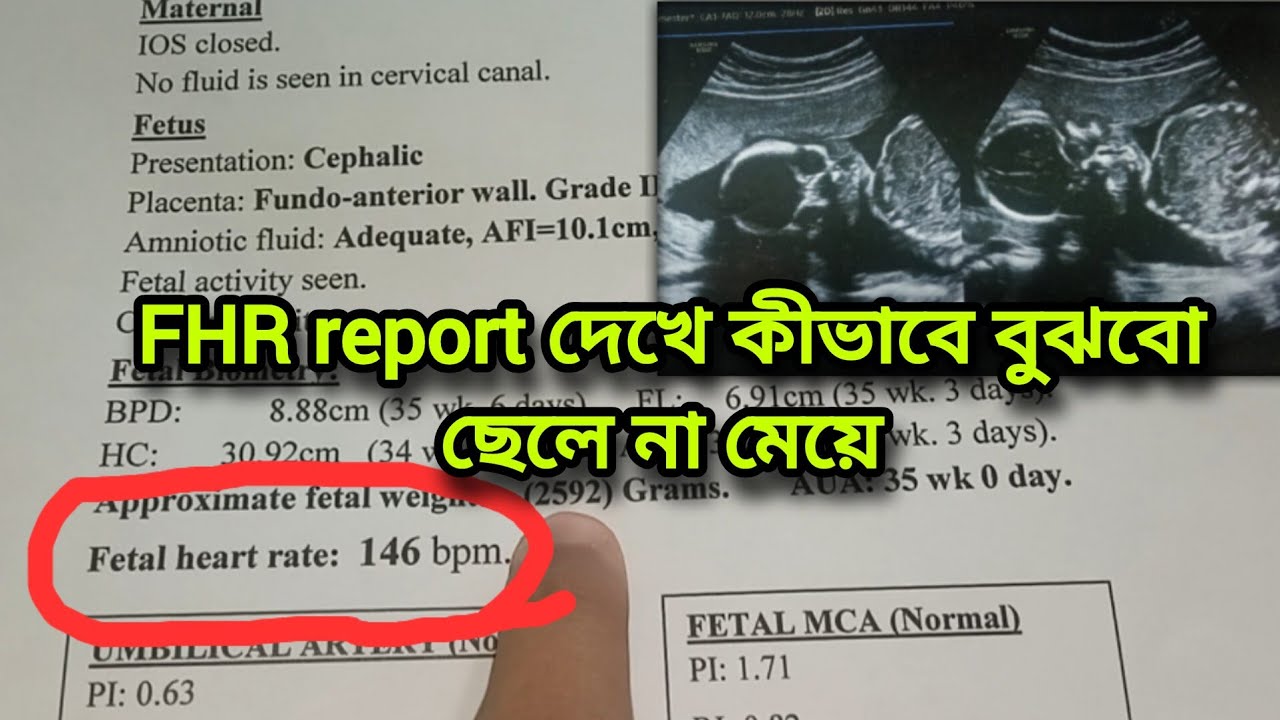 FHR report দেখে কীভাবে বুঝবো ছেলে না মেয়ে 💁‍♀️ - YouTube