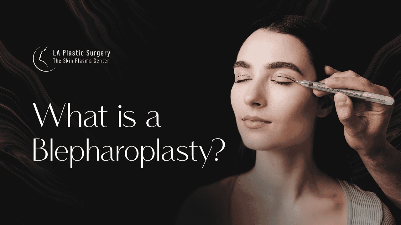 What is a Blepharoplasty? Eyelid Surgery Explained by Dr. Melinda ...