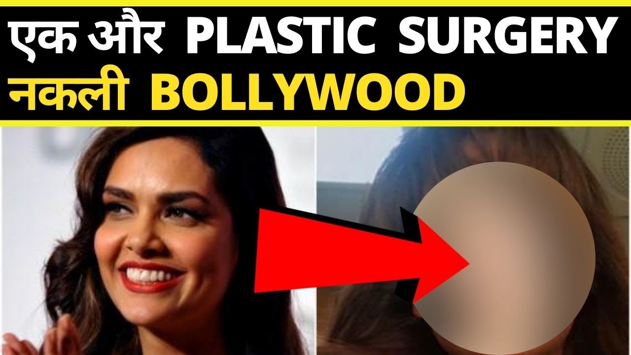 Esha Gupta's face changed after plastic surgery, SHOCKING ...