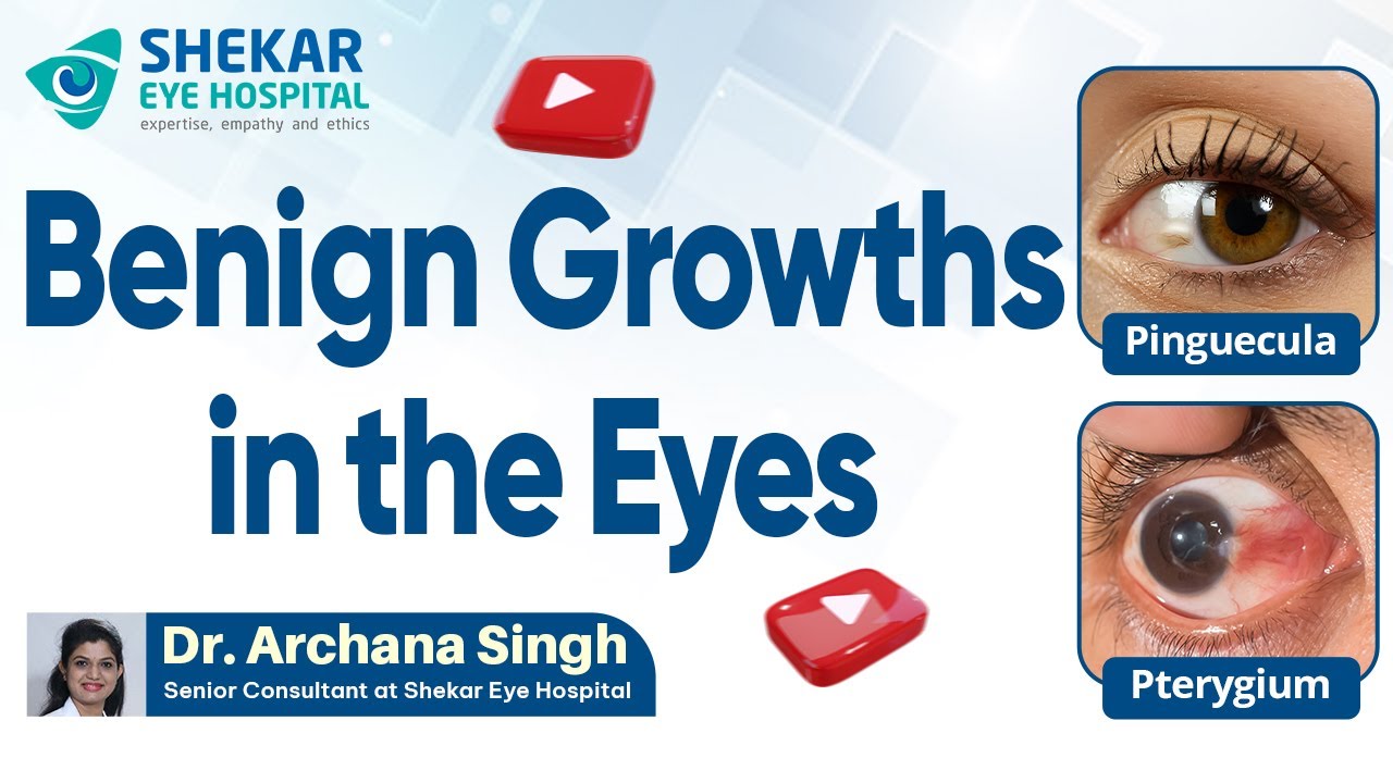 Growths on Eyes : Pinguecula vs. Pterygium | Shekar Eye Hospital - YouTube