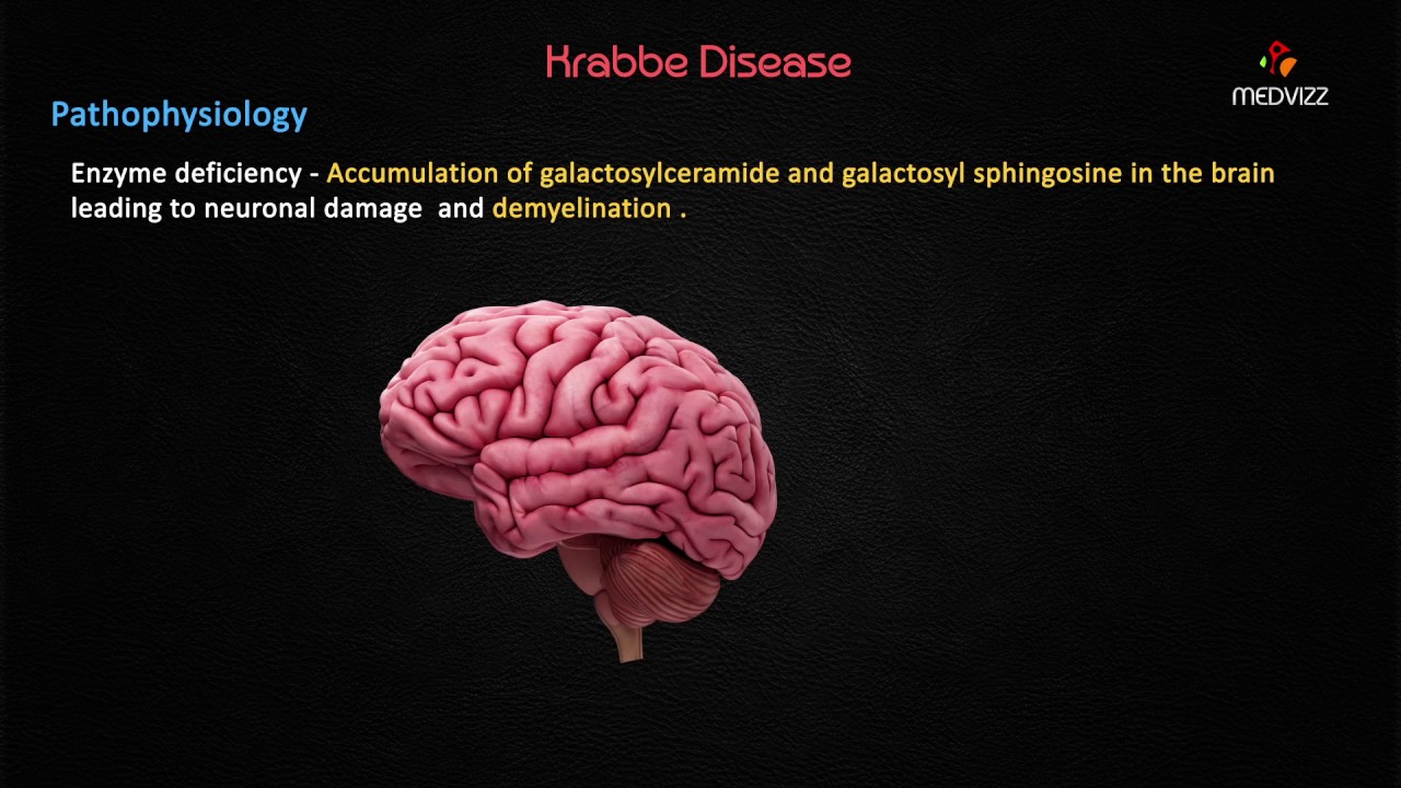 Krabbe Disease - Usmle Biochemistry Webinar based Lecture - YouTube