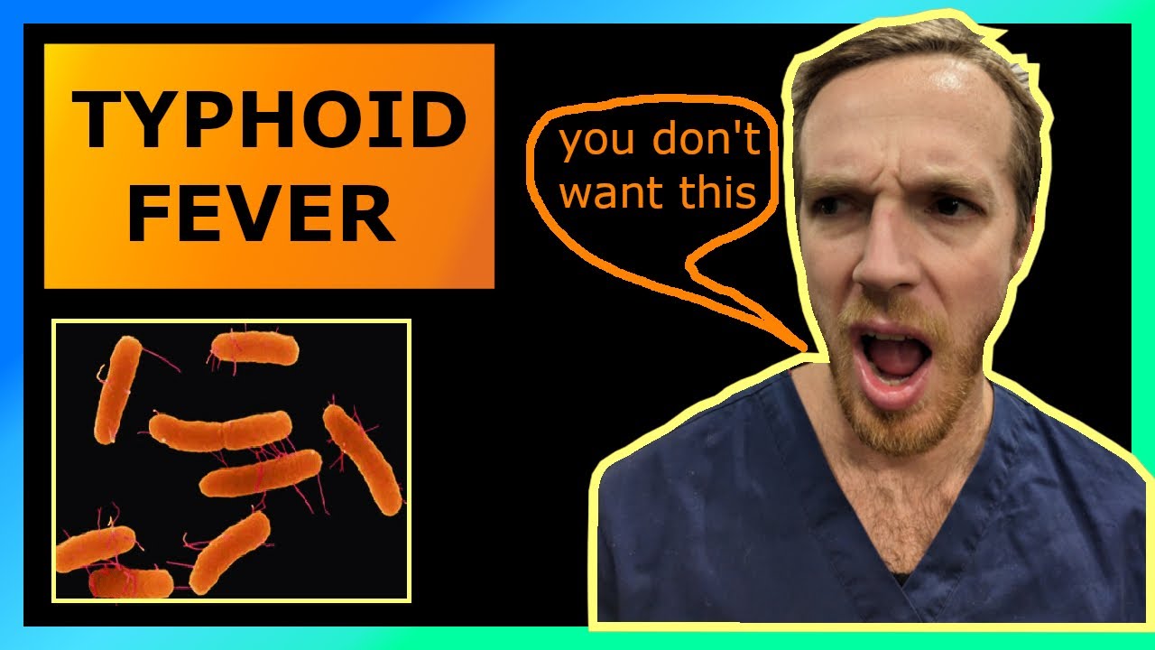Typhoid Fever, Symptoms, History and Prevention - YouTube