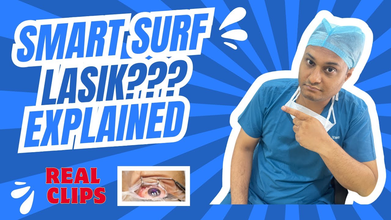 Smart surf lasik?? Explained in [hinglish] - YouTube