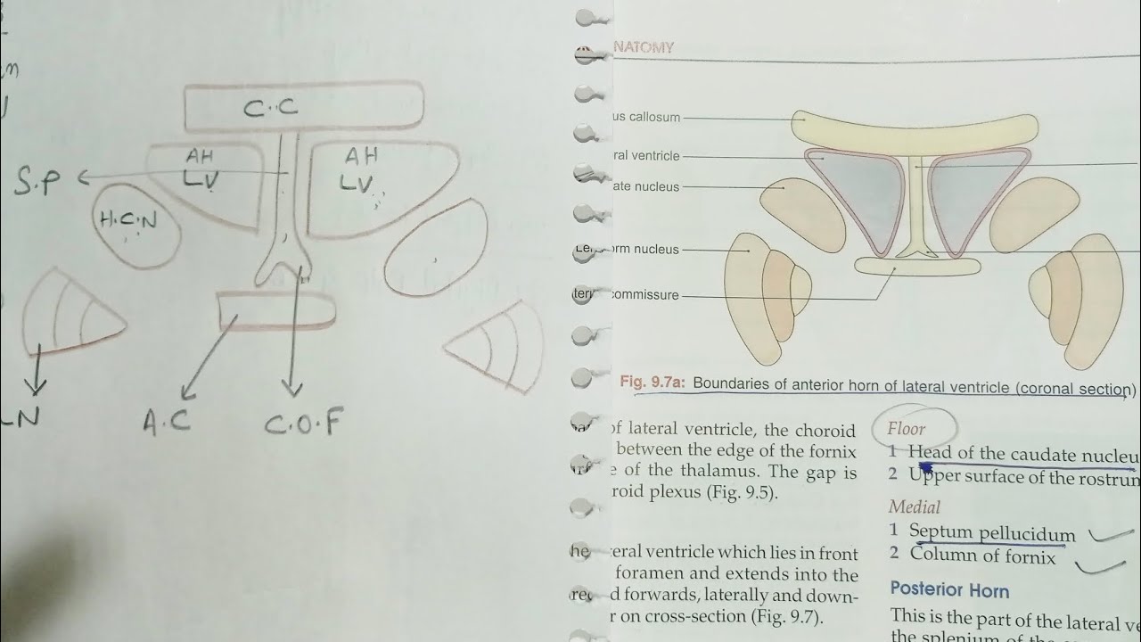 4.Anterior Horn of Lateral Ventricle in coronal section.; Neuroanatomy ...