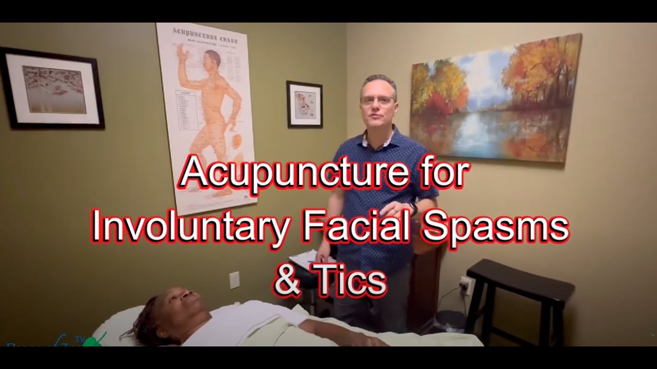 Facial Acupuncture for Spasms & tics | Real Treatment & Results - YouTube