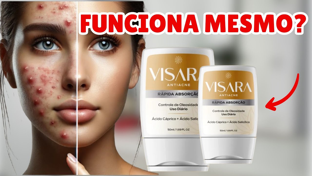 VISARA ANTIACNE é bom? Visara antiacne funciona? Melhor Creme antiacne ...
