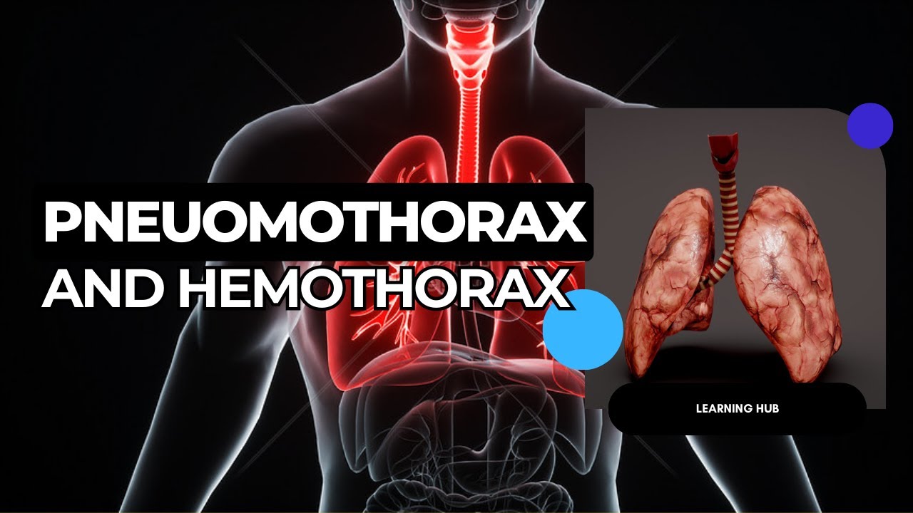 Pneumothorax and Hemothorax | Types & Management - YouTube