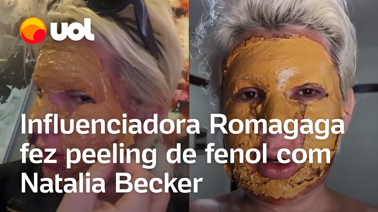 Peeling de fenol: Influencer fez procedimento na clínica onde homem ...